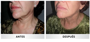 .::Dermoplástica::.