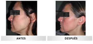 .::Dermoplástica::.